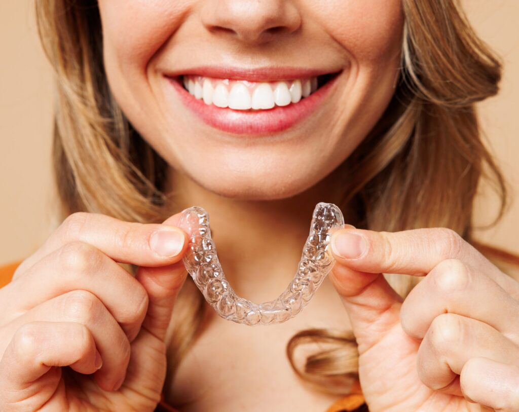 How Invisalign Attachments Work and Why They Matter - Silverlake ...